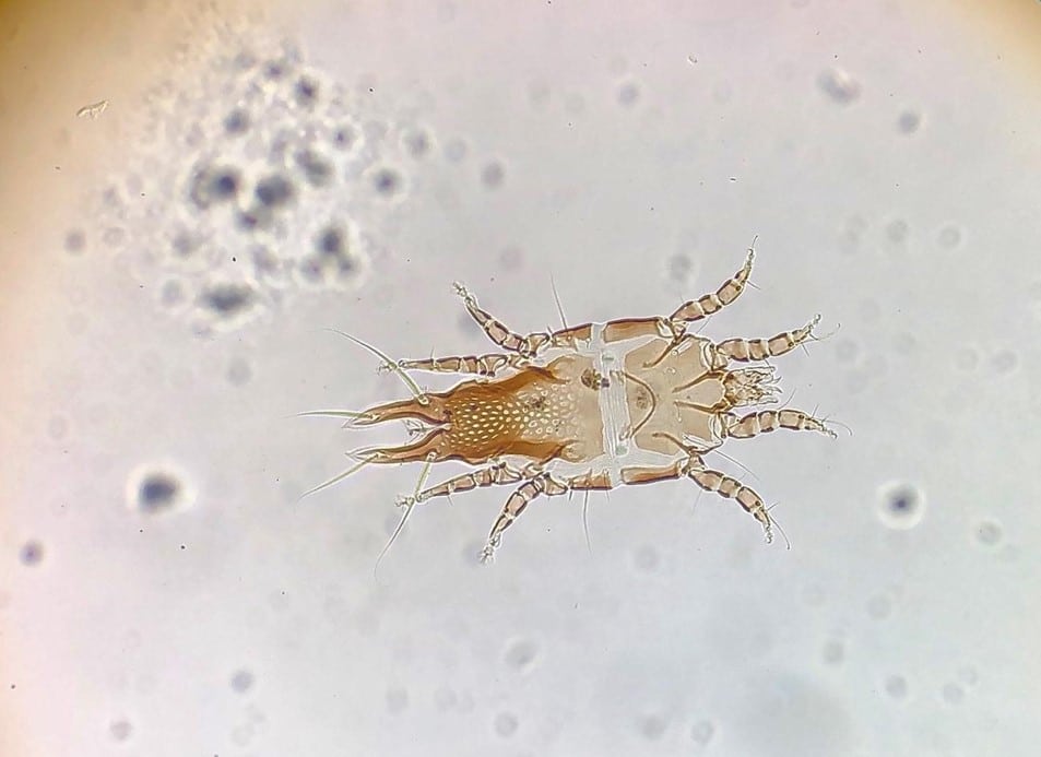 ¿Para estudiar aquí o para llevar?: Ácaros hasta en la sopa - La ...